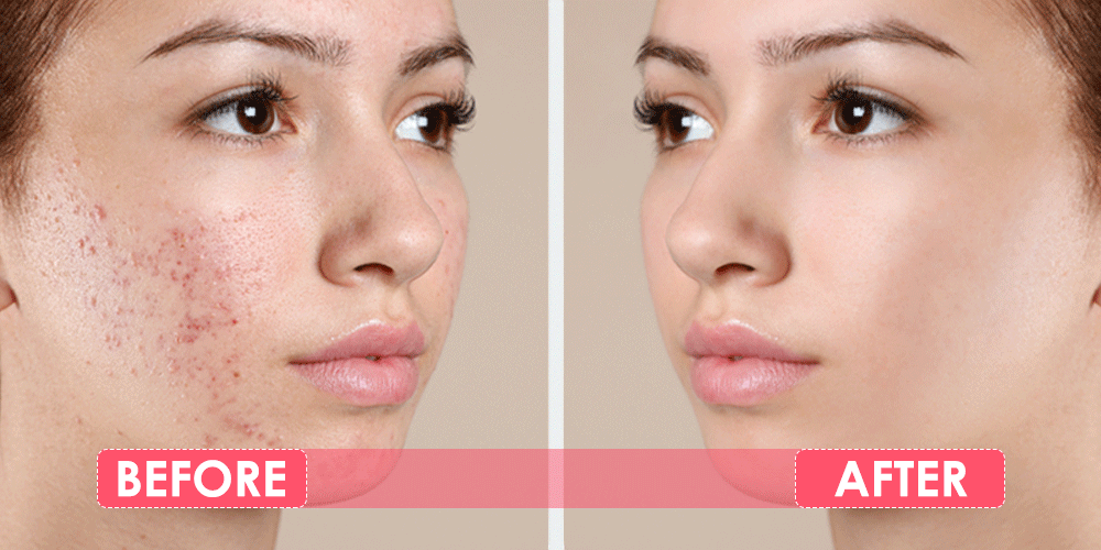 Get Skin and hair treatment at Derma Puritys